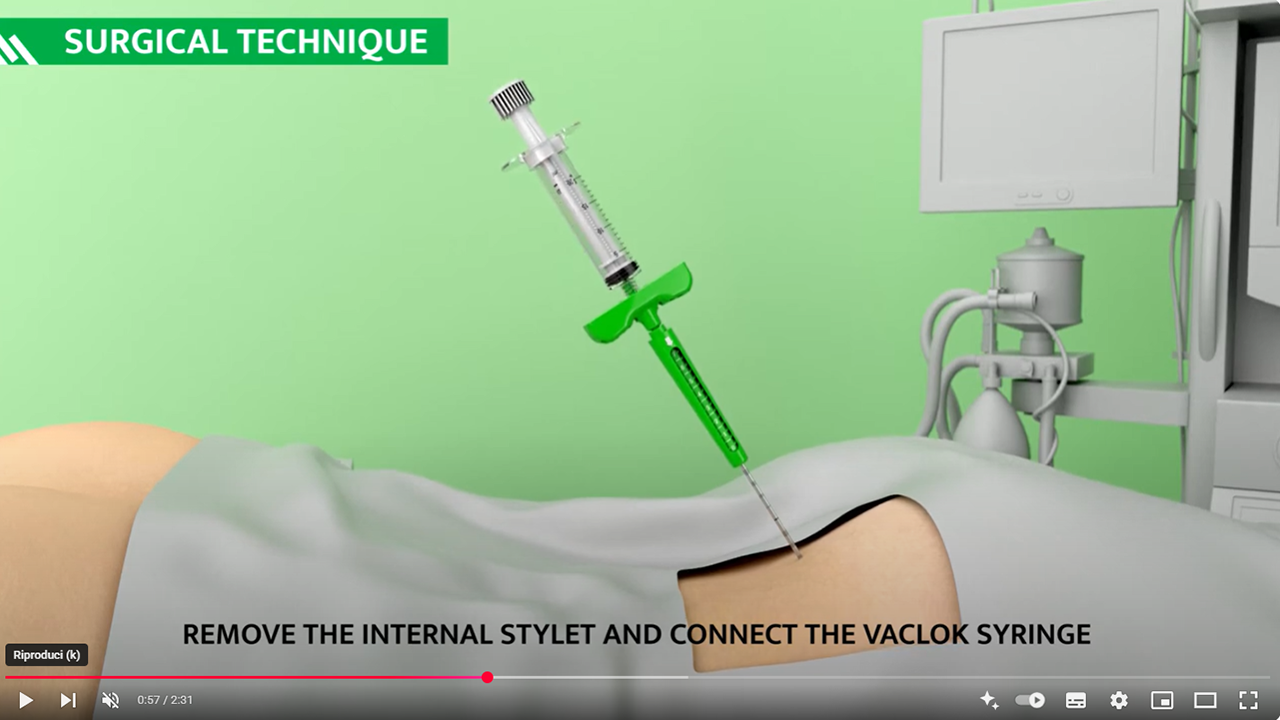 Biopsybell video tutorials BPB MEDICA™ - Biopsybell